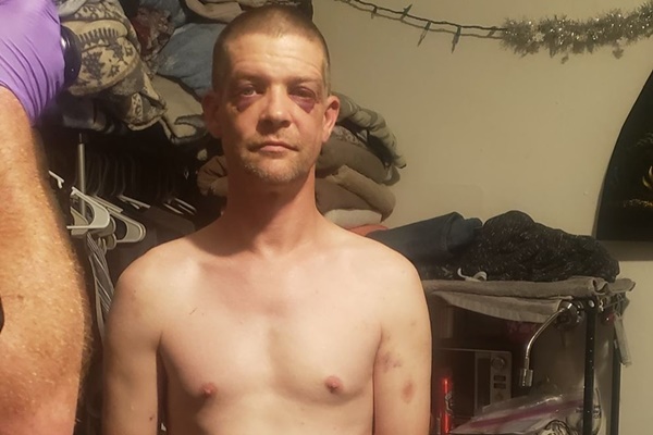 Portland’s Adam Haner: I don’t remember anything – CONAN Daily